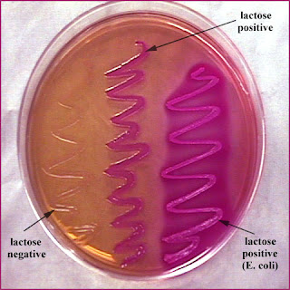 Biochemical Testing: MacConkey's Agar
