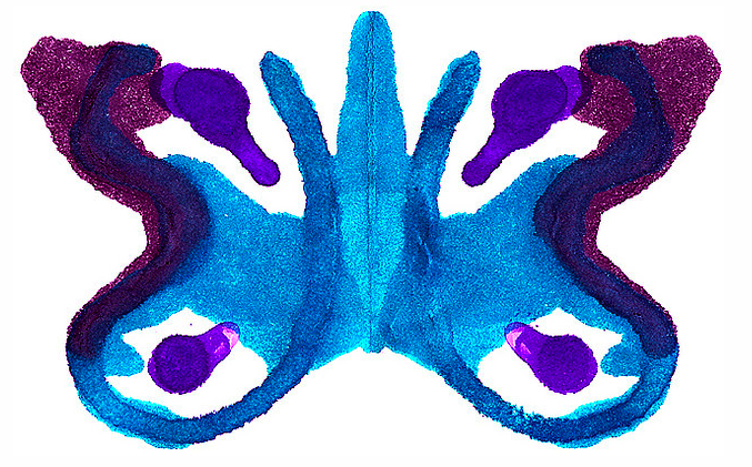 Dr. Deb: Inkblot Fun