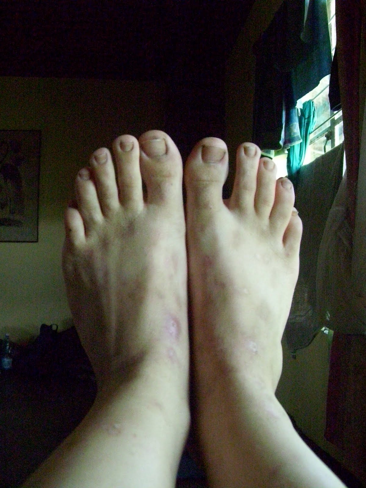 traveling with Jesus: One Day Without Shoes...