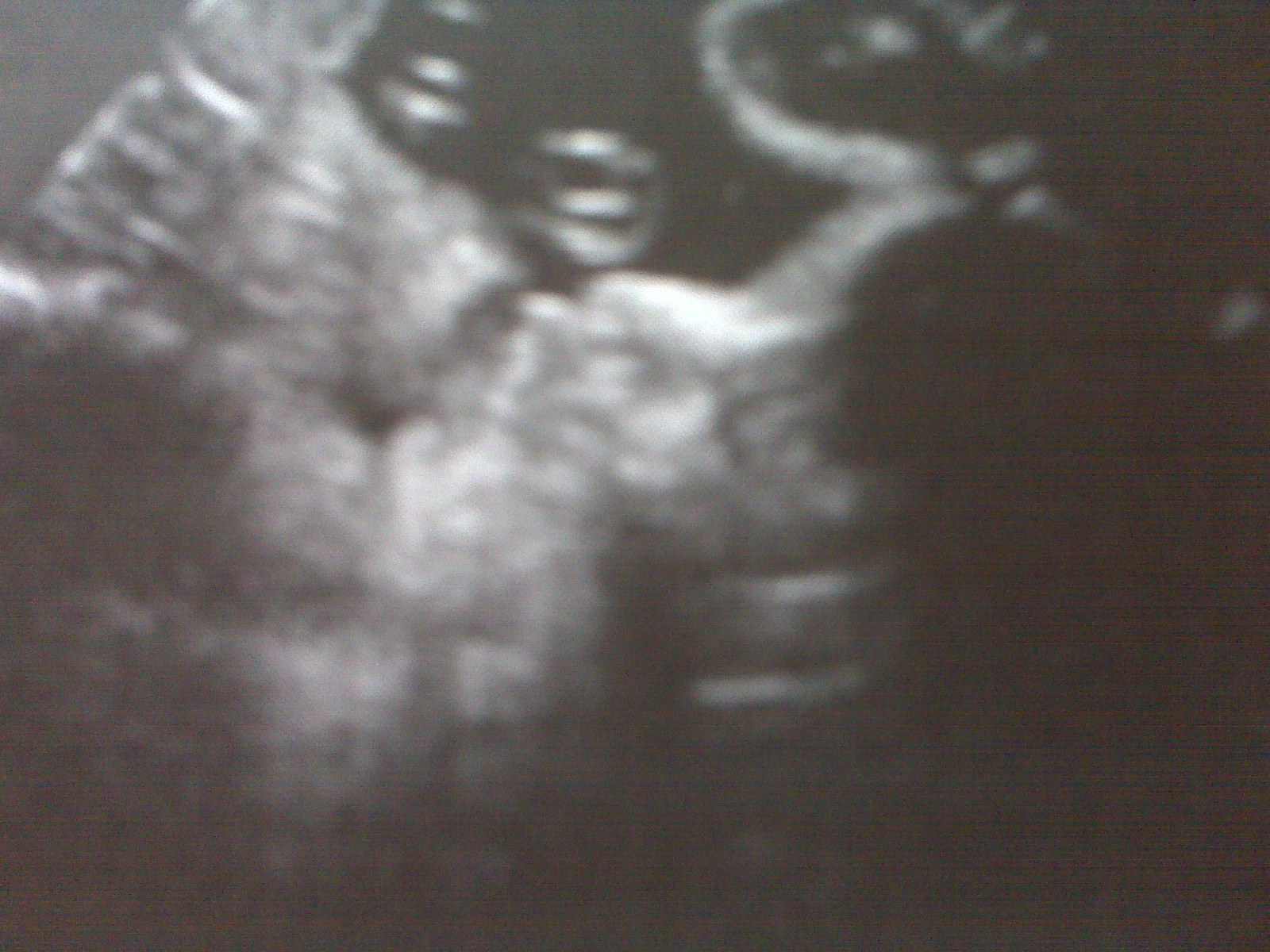 The Young Family: Baby Wyatt 32 weeks 4 days ultrasound