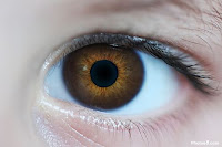 Agenesis Corpus Callosum: Teaching Resources