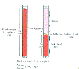 Hematokrit | Chlinical Pathology