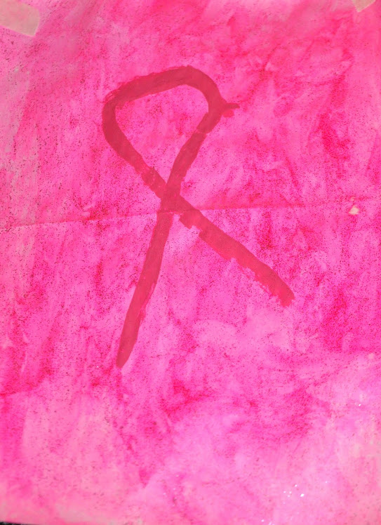 In The Pink: Radiation Day 18 or How Funky Socks to Battle Cancer