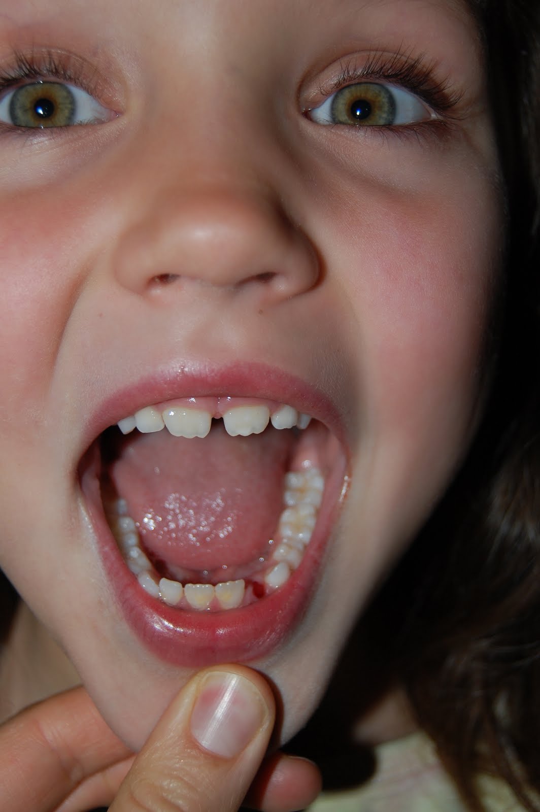 The Bingham Bunch: lost tooth