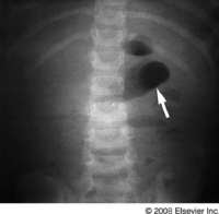 Webicine: Abdominal X-ray