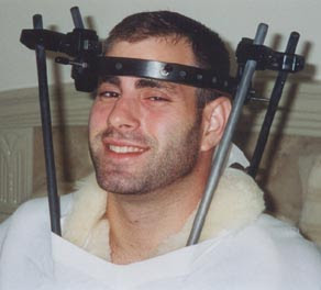 Just Another Posterior Atlanto-Axial Arthodesis