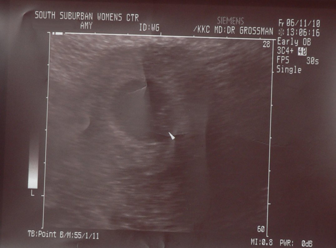 Amy and Brian's Family Life: Baby's First Ultrasound (6 weeks 6 days)