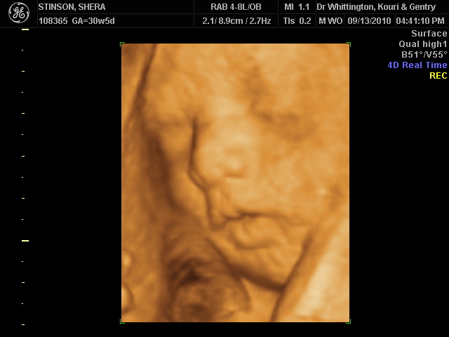 Stinson Scoop: 4D Ultrasound at 30 Weeks/7 Months