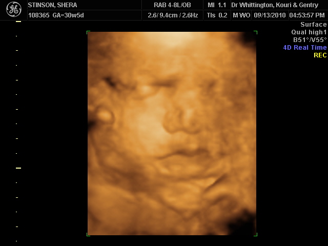 Stinson Scoop: 4D Ultrasound at 30 Weeks/7 Months