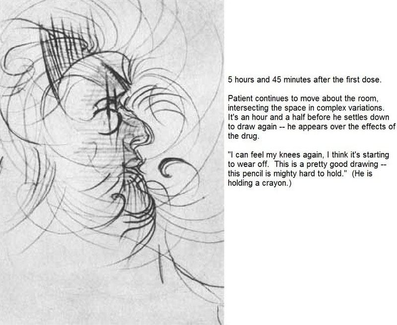 Art's state of the Art: Drawings under the influence of LSD