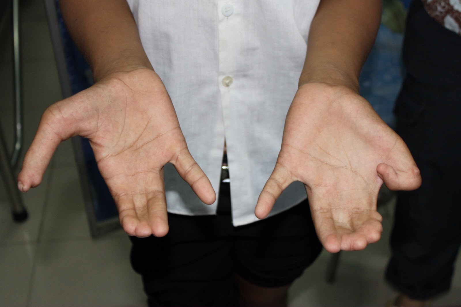 Day 6: At the Hospital