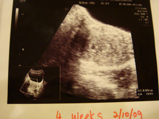 Ultrasound Scans