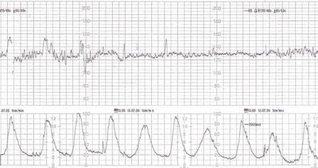 A Quatro mãos tudo melhor: Do registo cardiotocográfico...