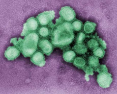 INFLUENZA A H1N1: IL VIRUS AH1N1