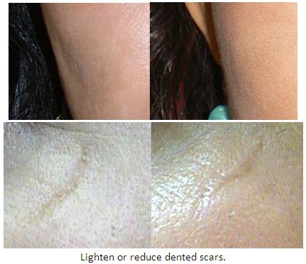 Breakthrough in Healthcare & Aesthetics: DermAureus - The Latest ...