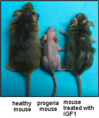 progeria family circle: can treatment with IGF1 help children with ...