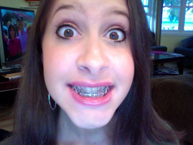 Surviving Jaw Surgery: Day 32 - My One Month Anniversary! - Photos!