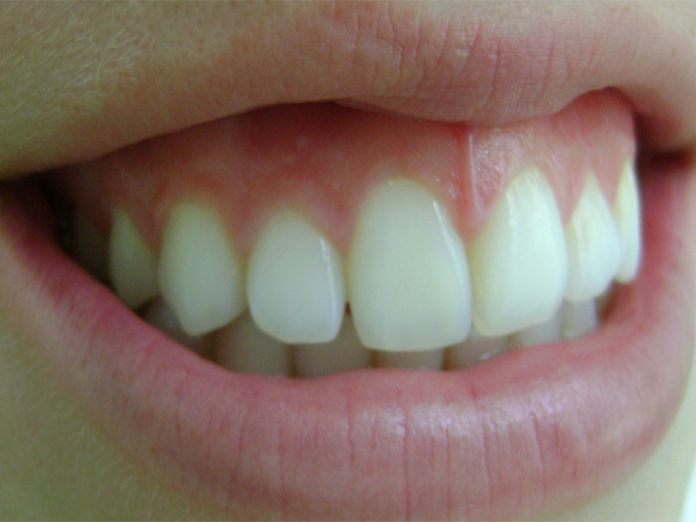 O Bocas: Aspectos de uma boca saudável