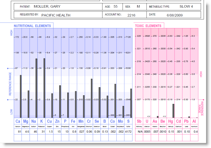 GaryMoller.com - Health, Fitness - Naturally!: How a Hair Tissue ...