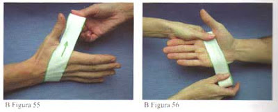 EMFV - Escuela de Porteros: TIPOS DE VENDAJES PARA LOS PORTEROS