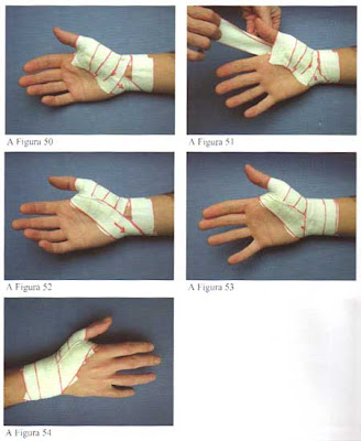 EMFV - Escuela de Porteros: TIPOS DE VENDAJES PARA LOS PORTEROS