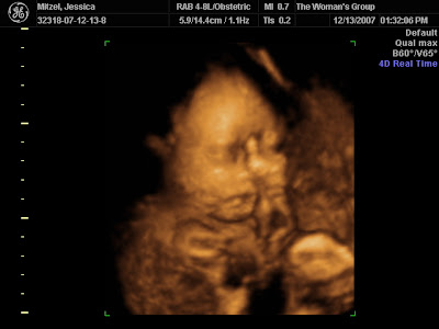The Mitzels: 4D Ultrasound-27 weeks 5 days