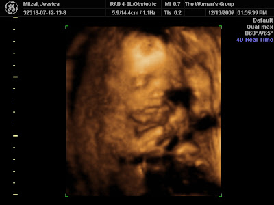 The Mitzels: 4D Ultrasound-27 weeks 5 days