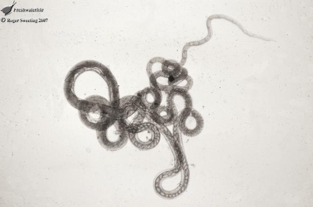 PARASITARIAS: CAPILLARIA SP