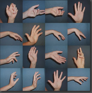 SURGERY OPERATION: COMPLEX HAND LACERATIONS