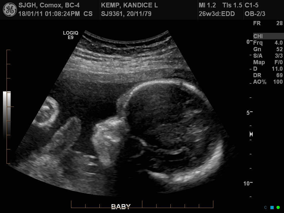 Baby Eschbaumer: Baby Ultrasound 26 weeks 3 days!