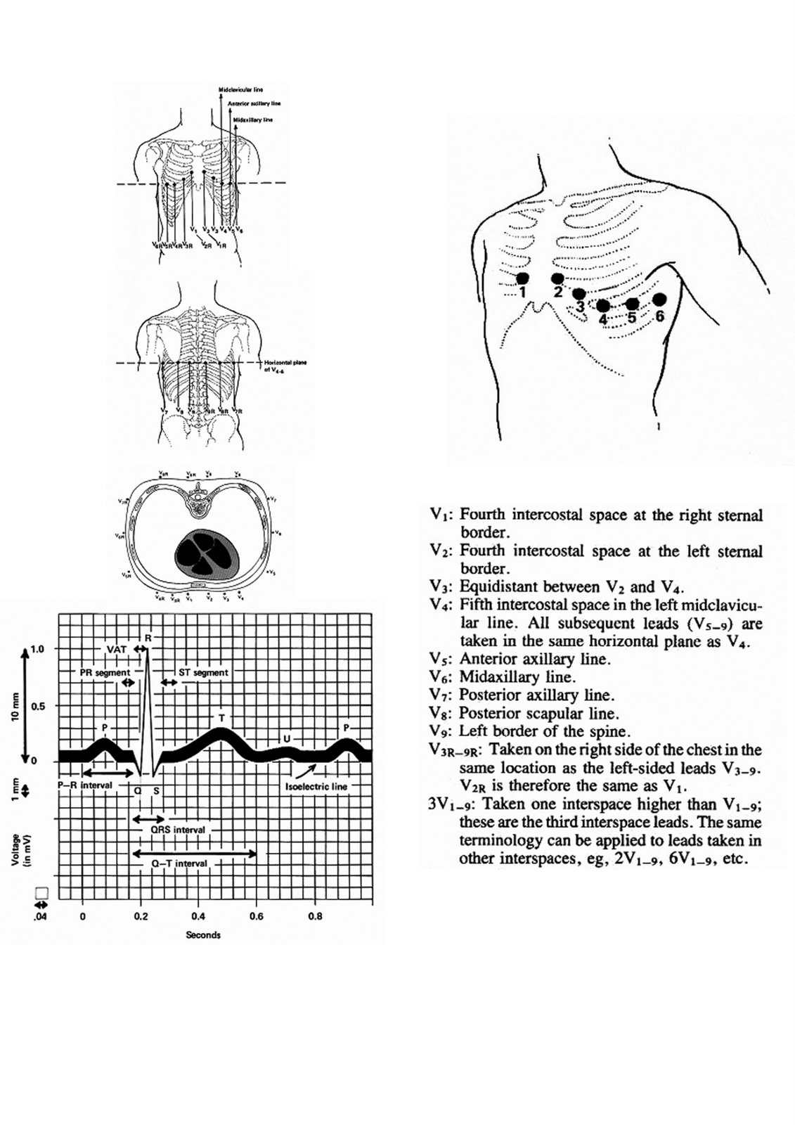 MEDICAL BLOG: PROSEDUR PEREKAMAN JANTUNG DENGAN EKG