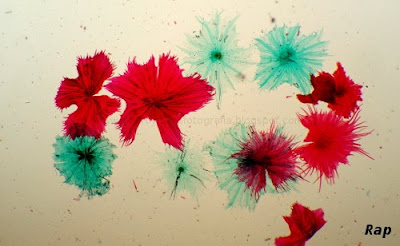 Macro y microfotografia: Microfotografía: Escamas de cabello