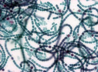 Ósmosis: Cianobacterias