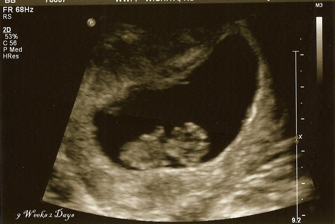 Monkey Tales: 9 weeks 2 days with ultrasound pics!!!
