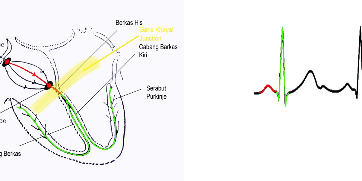 PERAWAT GAWAT DARURAT: DASAR-DASAR EKG