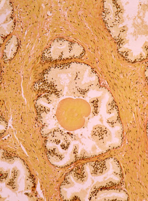 Tecnología Médica Mención Morfofisiopatología y Citodiagnóstico ...