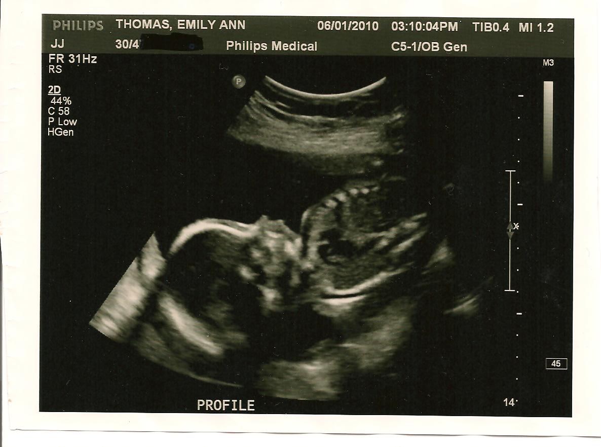 our family: 21 weeks and Ultrasound Photo