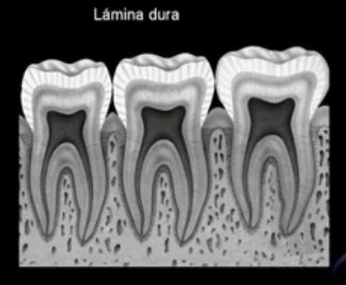 El blog de radio: Lámina Dura o Cortical Alveolar en Radiografía