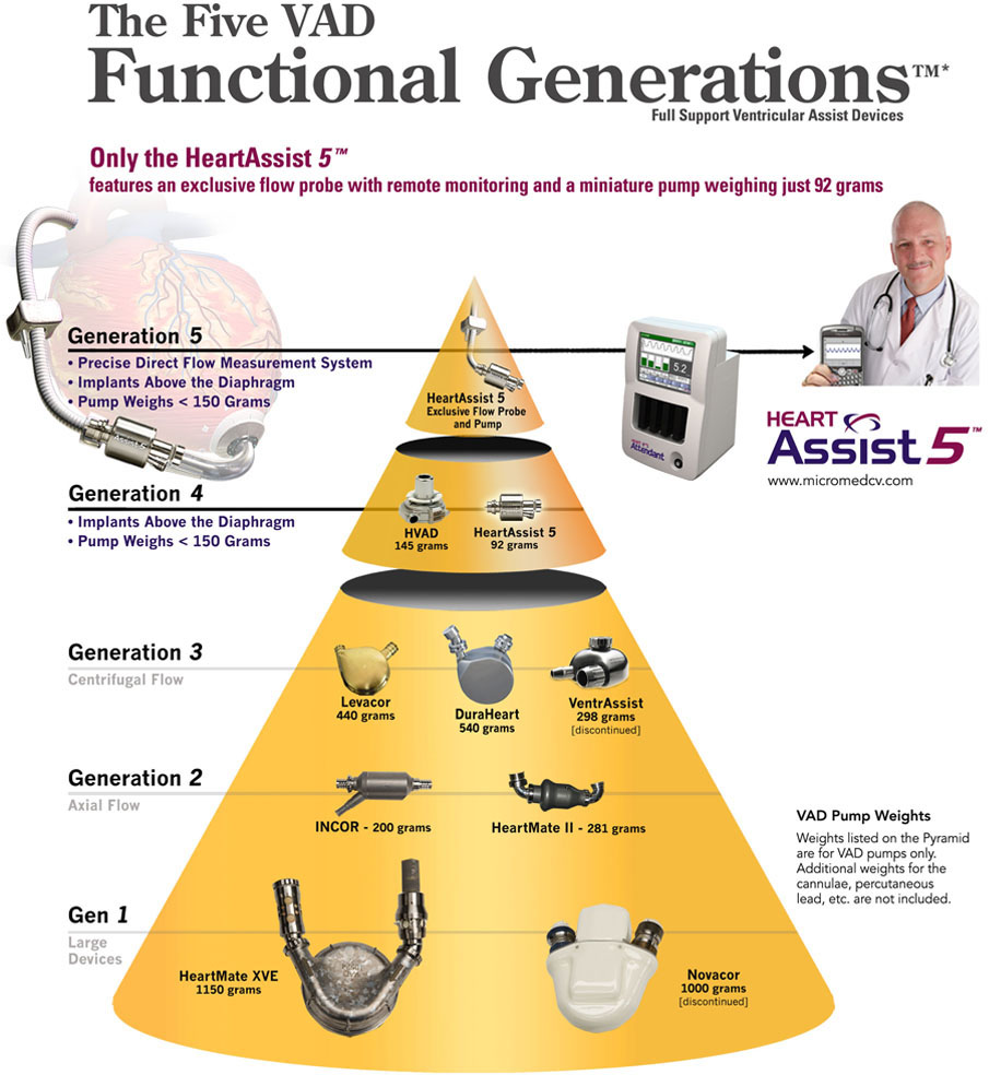 FromTheBottomOfMyLVAD With A Thoratec HeartMate II: THE LVAD IN AN ...