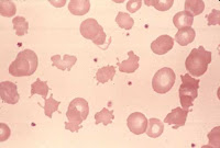 EL RINCÓN DE LA MEDICINA INTERNA. juanpedromacaluso@yahoo.com.ar ...