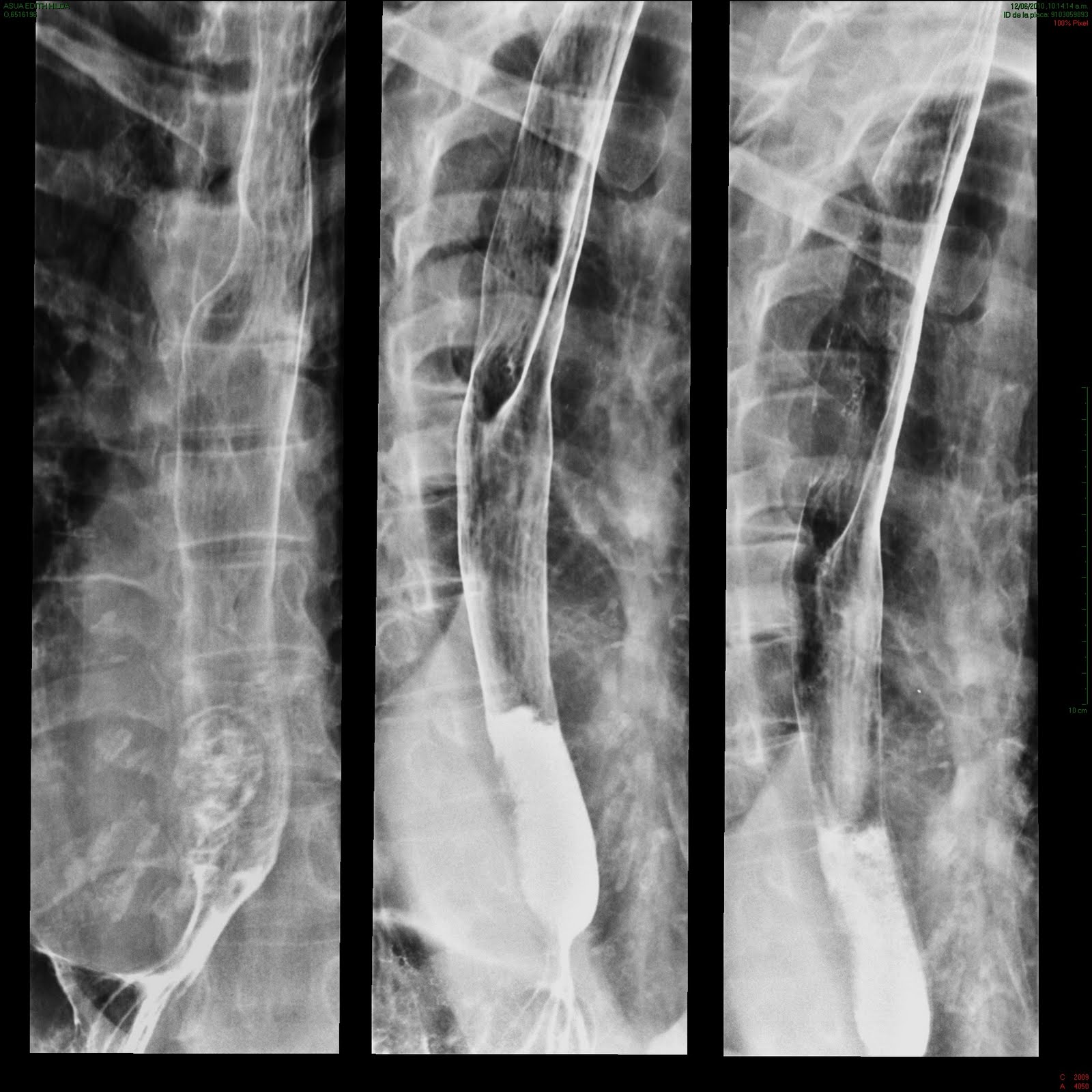EL RINCÓN DE LA MEDICINA INTERNA. juanpedromacaluso@yahoo.com.ar: 8 jul ...