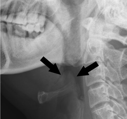 EL RINCÓN DE LA MEDICINA INTERNA. juanpedromacaluso@yahoo.com.ar ...