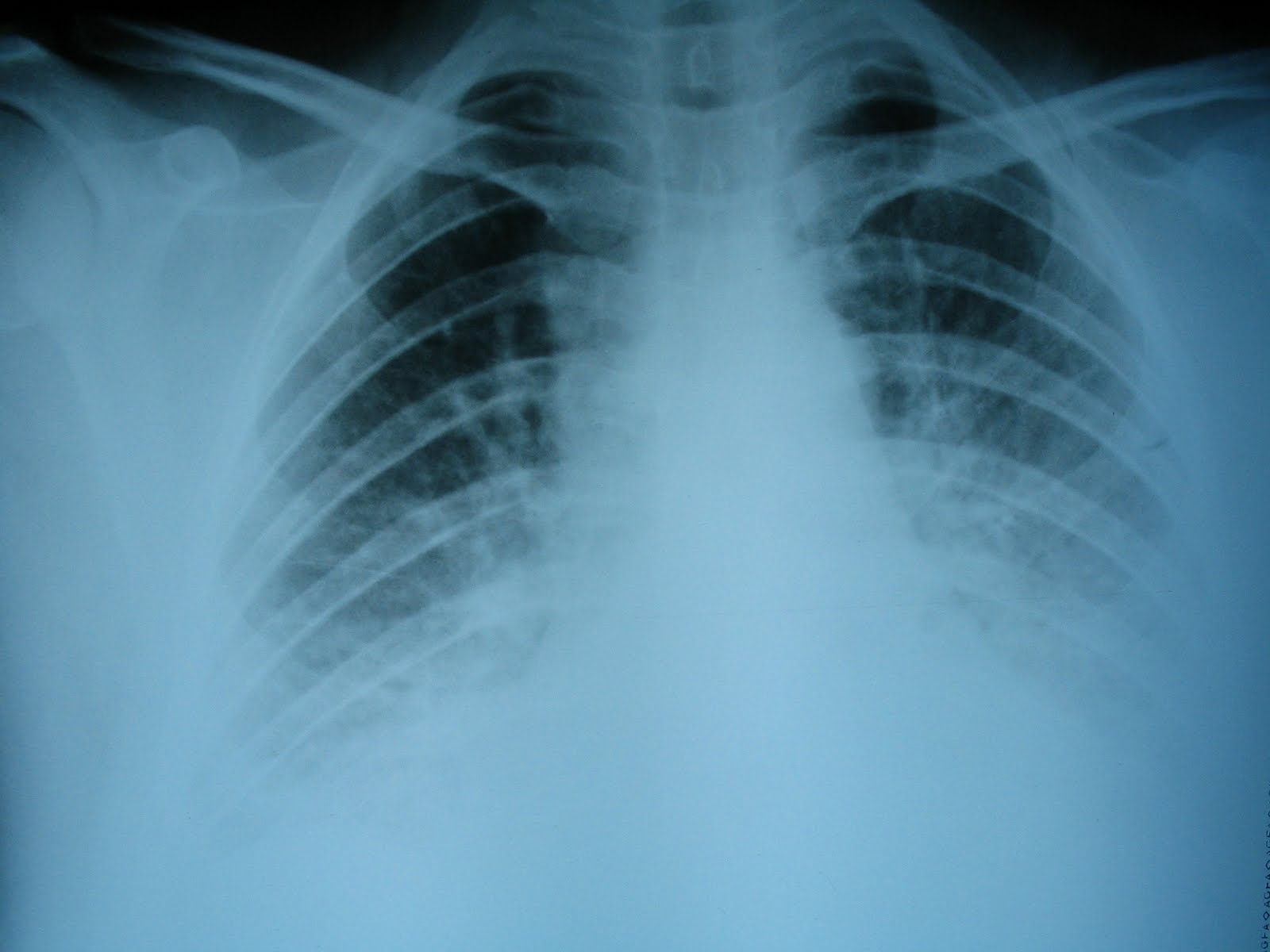 EL RINCÓN DE LA MEDICINA INTERNA. juanpedromacaluso@yahoo.com.ar: 6 ago ...