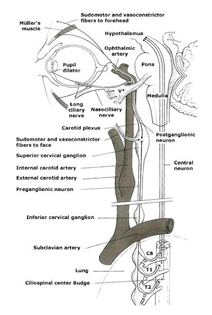 ENTORNO MÉDICO: Sindrome de Horner
