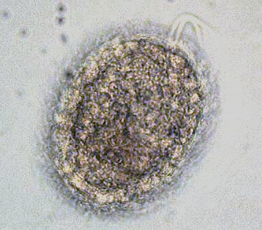Invertebrate Embryology: Planuliform Nemertean Larvae