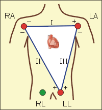 Images of the Heart: Placement of EKG leads
