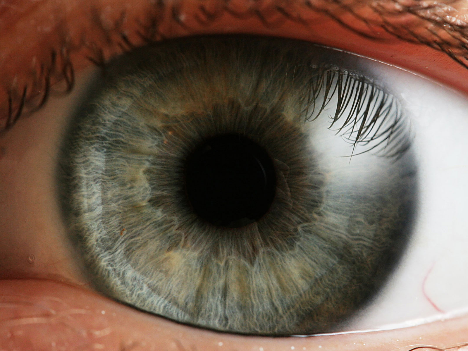 Cirugía Refractiva con Laser LASIK: Instrucciones Pacientes Operados ...