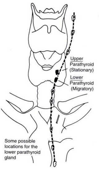 Radiology Facts: Parathyroid Embryology