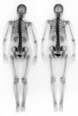 Biomedical Engineering (INSTRUMENTS)