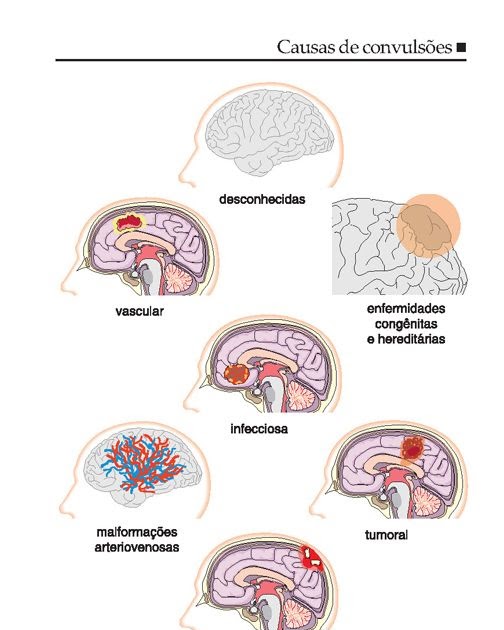 SISTEMA NERVOSO: Todos querem saber: o que são mesmo as Convulsões?